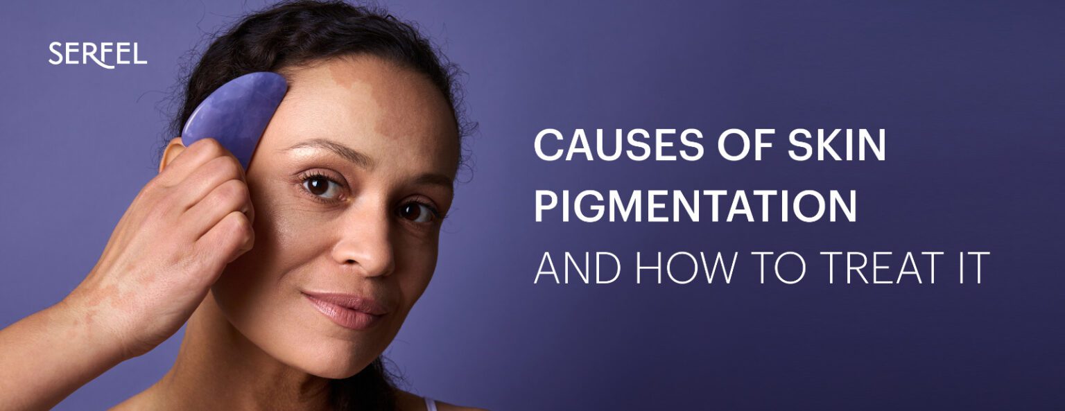 Causes of Skin Pigmentation and How to Treat it - سيرفل